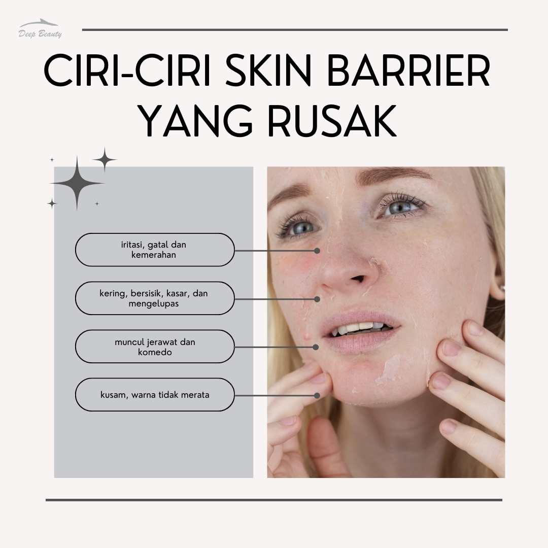 3+ Cara Memperbaiki Skin Barrier Yang Rusak, Mudah